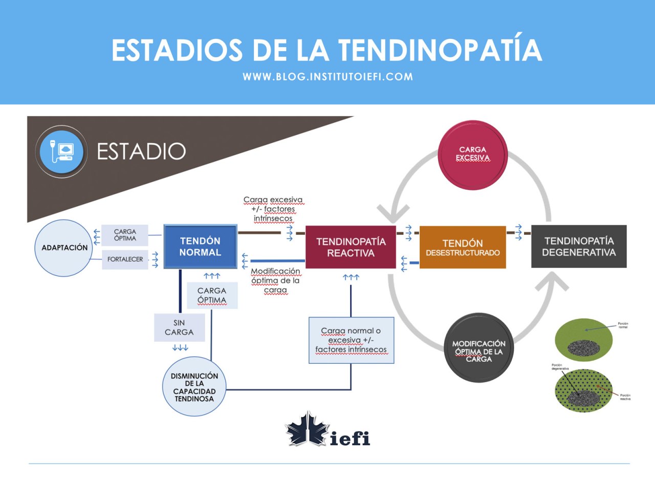 Tendinopatía: estadios - Blog del Instituto IEFI